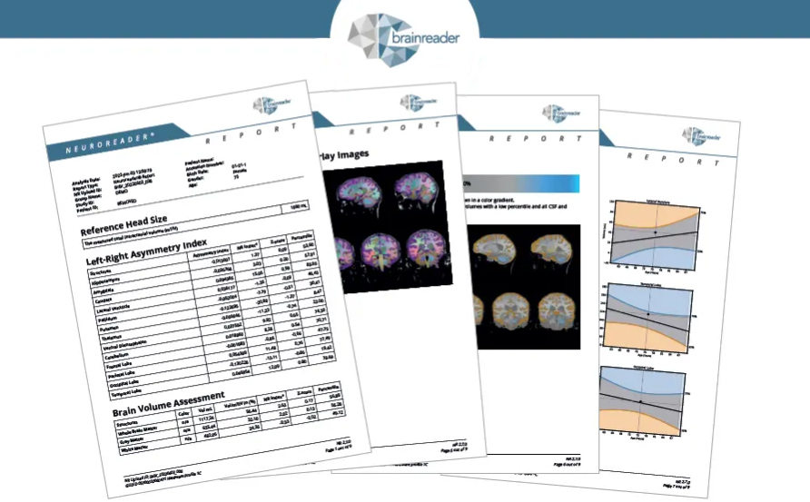 Brainreader | FDA-Cleared Brain Volumetric MRI Software for Neurodegen